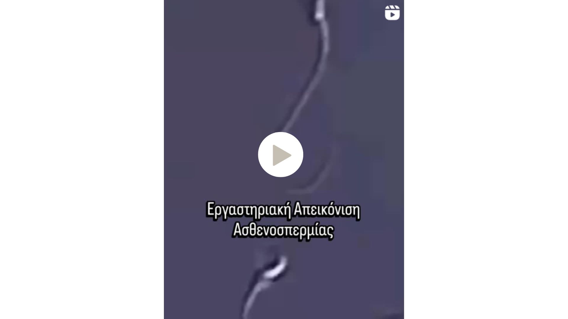 Τί σημαίνει η χαμηλή ή επιτόπια κινητικότητα σπερματοζωαρίων; - Δρ ...
